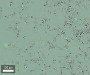 生細胞イメージングシステム CELLCYTE X アプリケーション | セルバイオロジー | バイオサイエンス | 【AXEL】アズワン