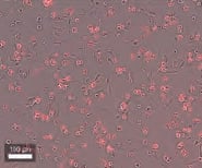 生細胞イメージングシステム CELLCYTE X アプリケーション | セルバイオロジー | バイオサイエンス | 【AXEL】アズワン