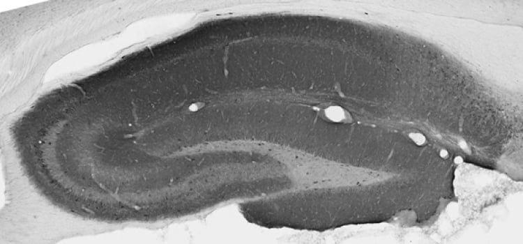 NeuroMab神経細胞向け免疫組織染色（IHC）評価/検証済み抗体 | 研究試薬はアズワン！ | 【AXEL】アズワン