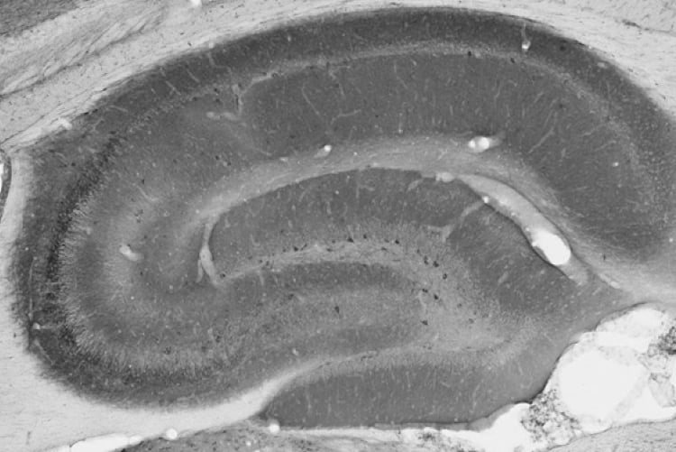 NeuroMab神経細胞向け免疫組織染色（IHC）評価/検証済み抗体 | 研究試薬はアズワン！ | 【AXEL】アズワン