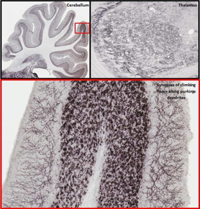 NeuroMab神経細胞向け免疫組織染色（IHC）評価/検証済み抗体 | 研究試薬はアズワン！ | 【AXEL】アズワン